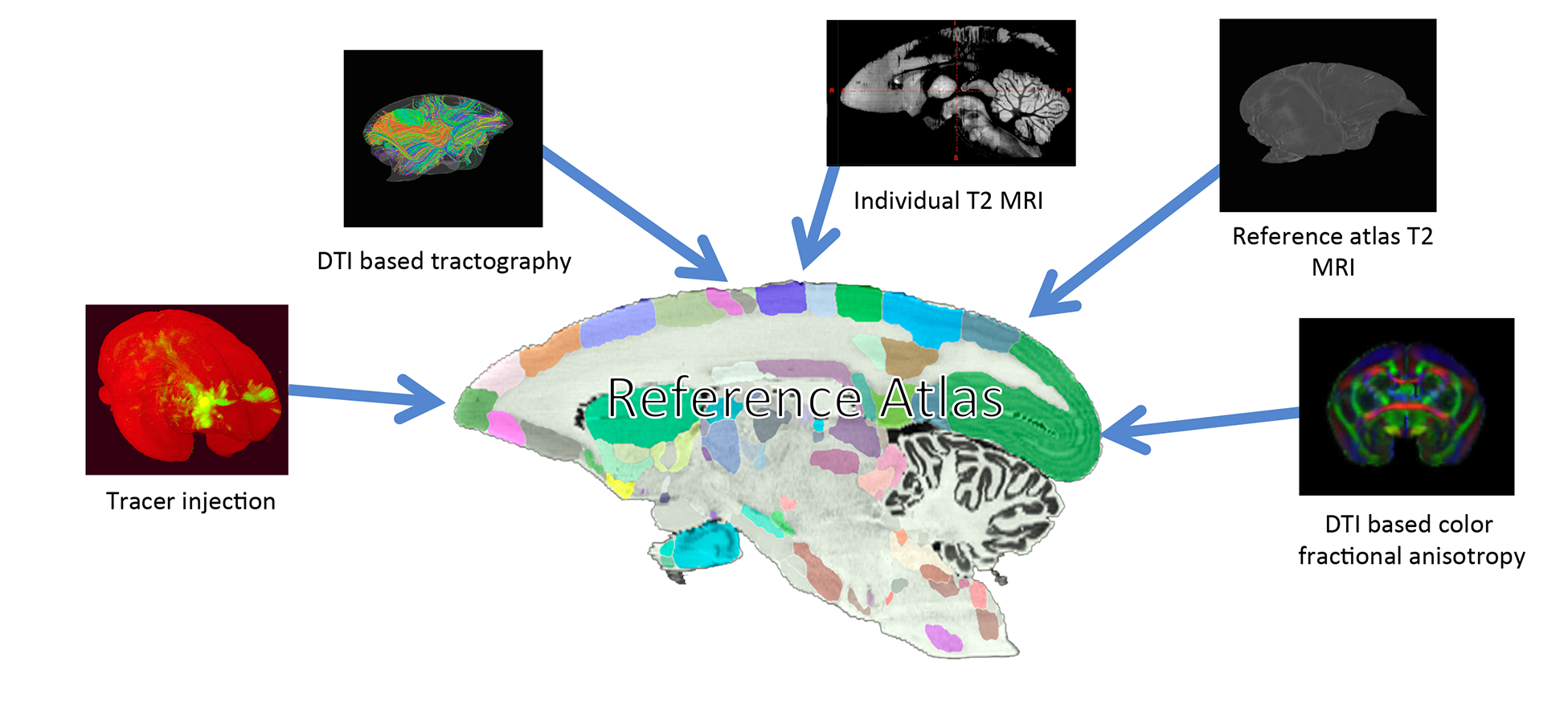 structural-map-infographic – Brain/MINDS