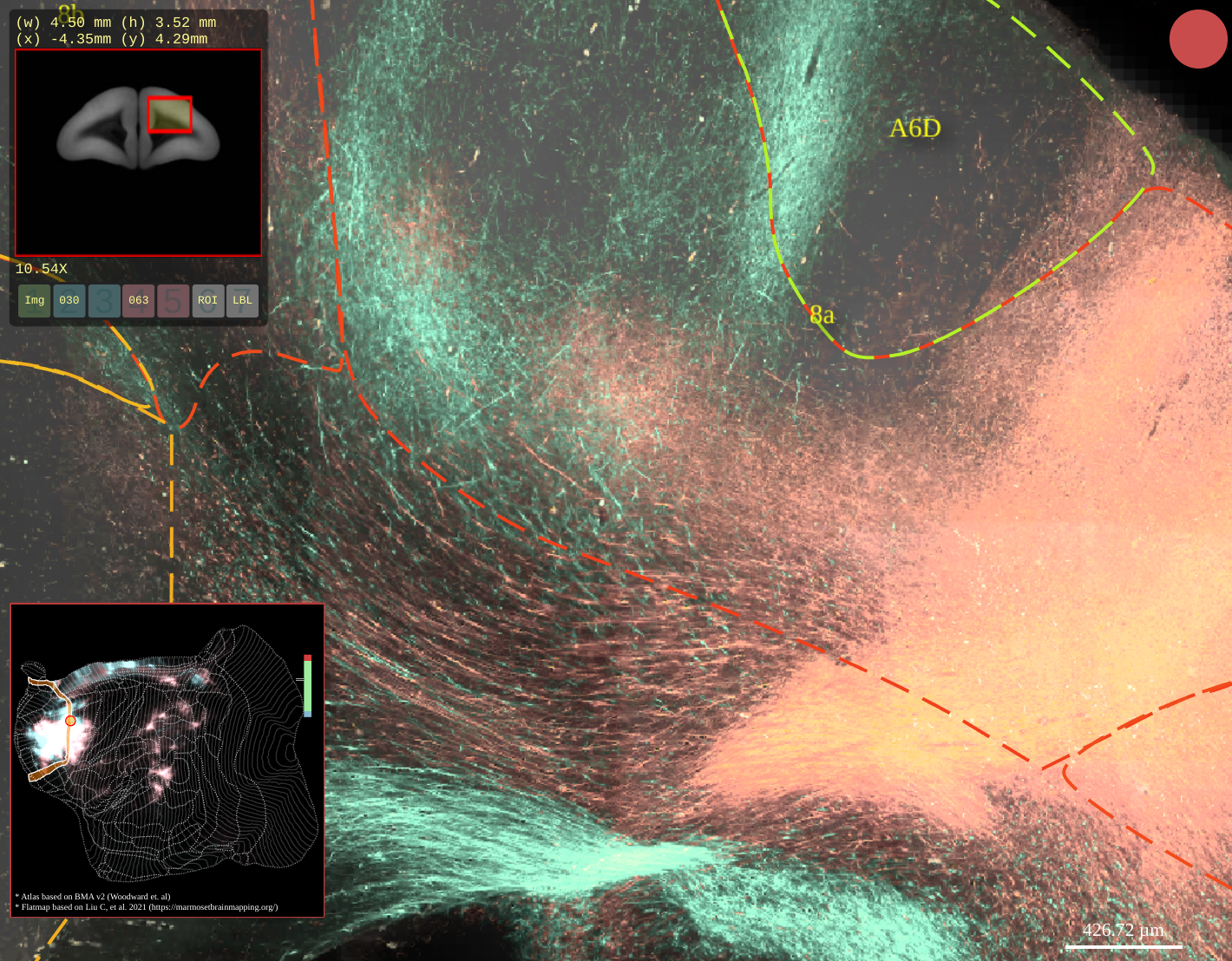 Brain/MINDS Marmoset Connectivity Atlas - Brain/MINDS