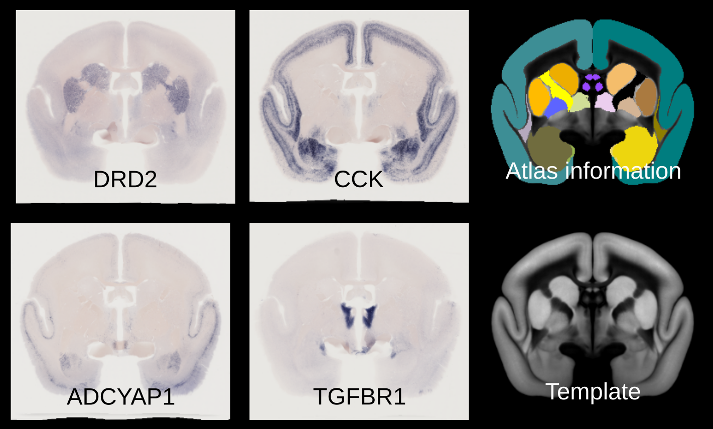 Gene Expression Connectivity Mapping – Brain/MINDS