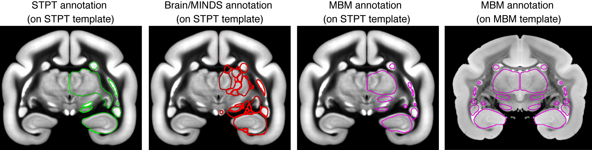 Technical Details - Brain/MINDS
