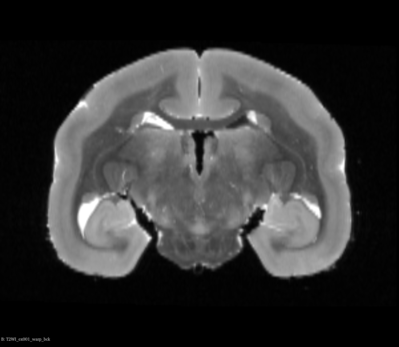 Tutorial: How to Make a Symmetric Brain - Brain/MINDS