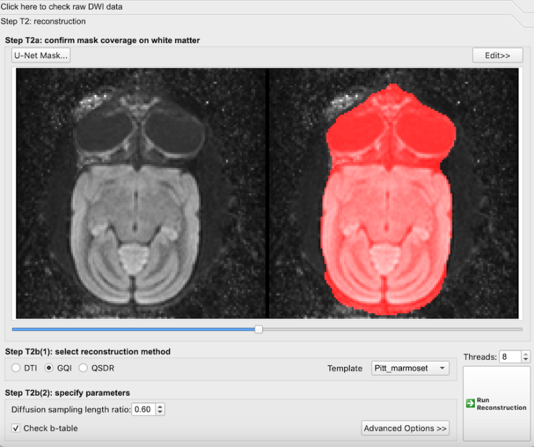 DWI Marmoset Brain Connectivity - Brain/MINDS