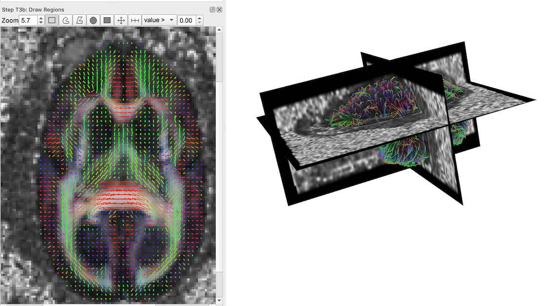 DWI Marmoset Brain Connectivity - Brain/MINDS