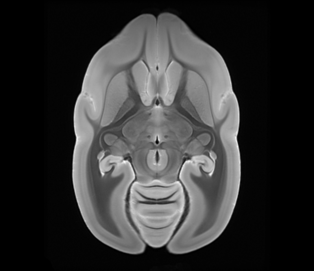 Tutorial: How to Make a Symmetric Brain - Brain/MINDS