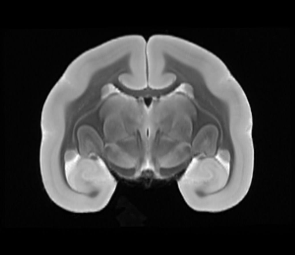 Tutorial: How to Make a Symmetric Brain - Brain/MINDS