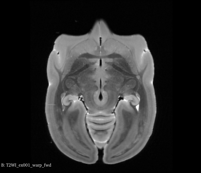 Tutorial: How to Make a Symmetric Brain - Brain/MINDS