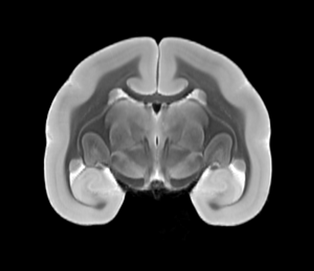 Tutorial: How to Make a Symmetric Brain - Brain/MINDS