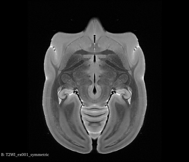 Tutorial: How to Make a Symmetric Brain - Brain/MINDS