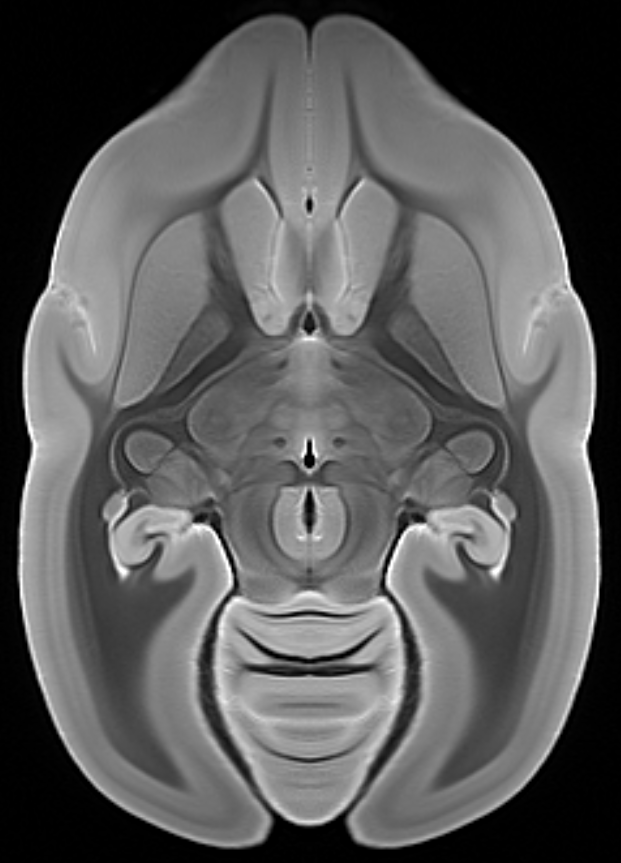 Tutorial: How to Make a Symmetric Brain - Brain/MINDS