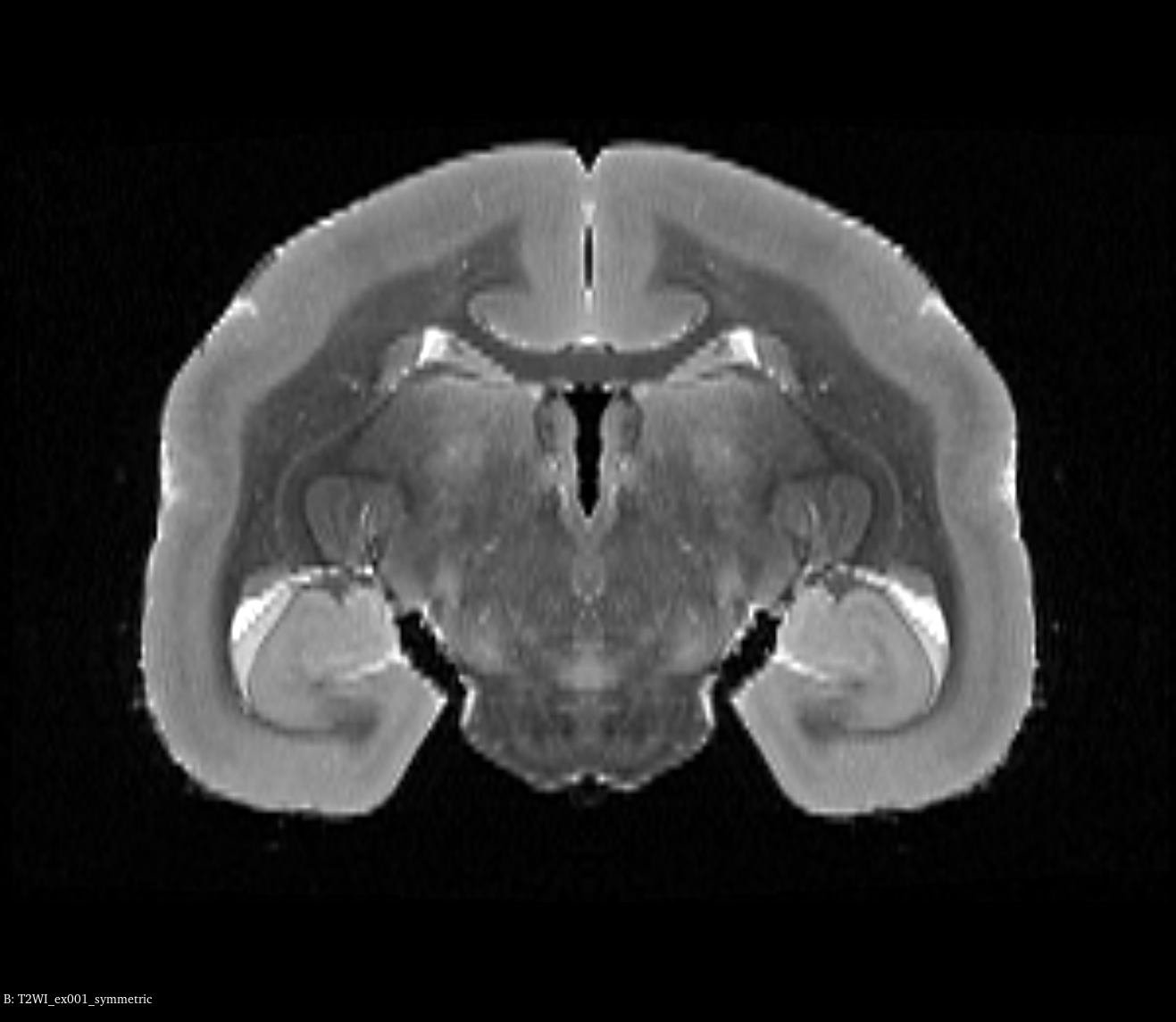 Tutorial: How to Make a Symmetric Brain - Brain/MINDS