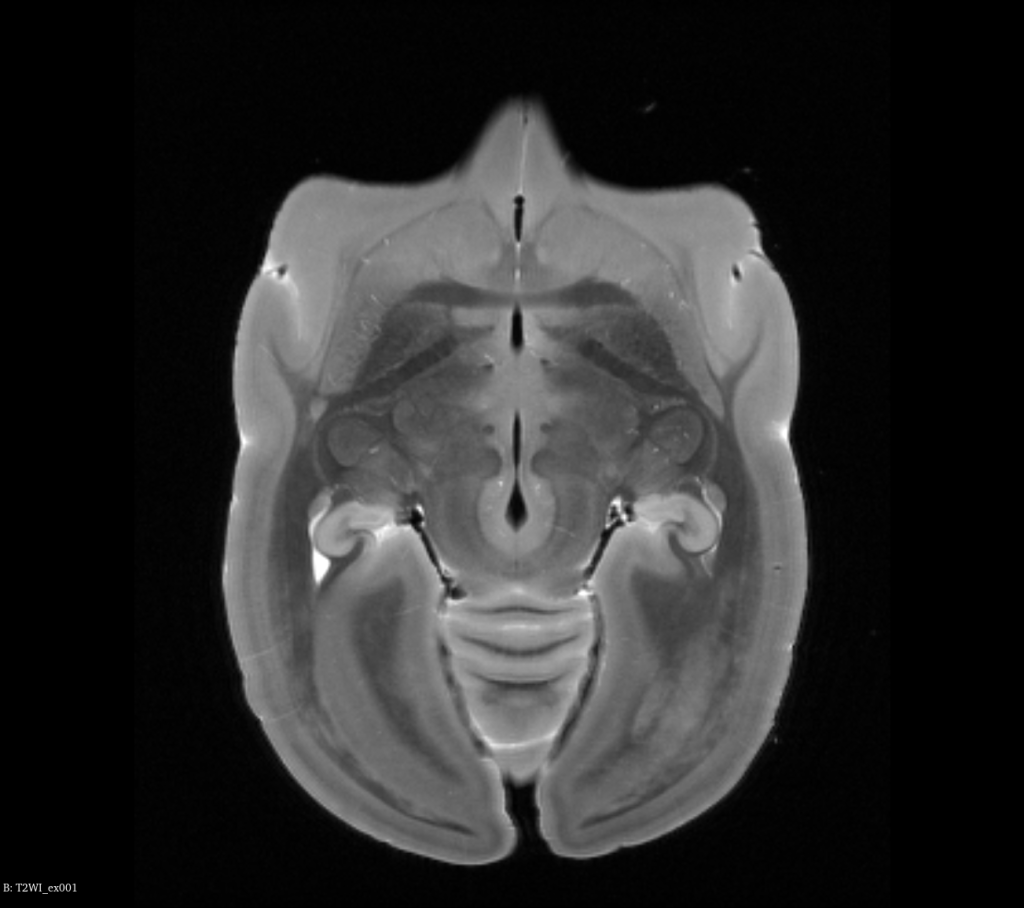 Tutorial: How to Make a Symmetric Brain - Brain/MINDS