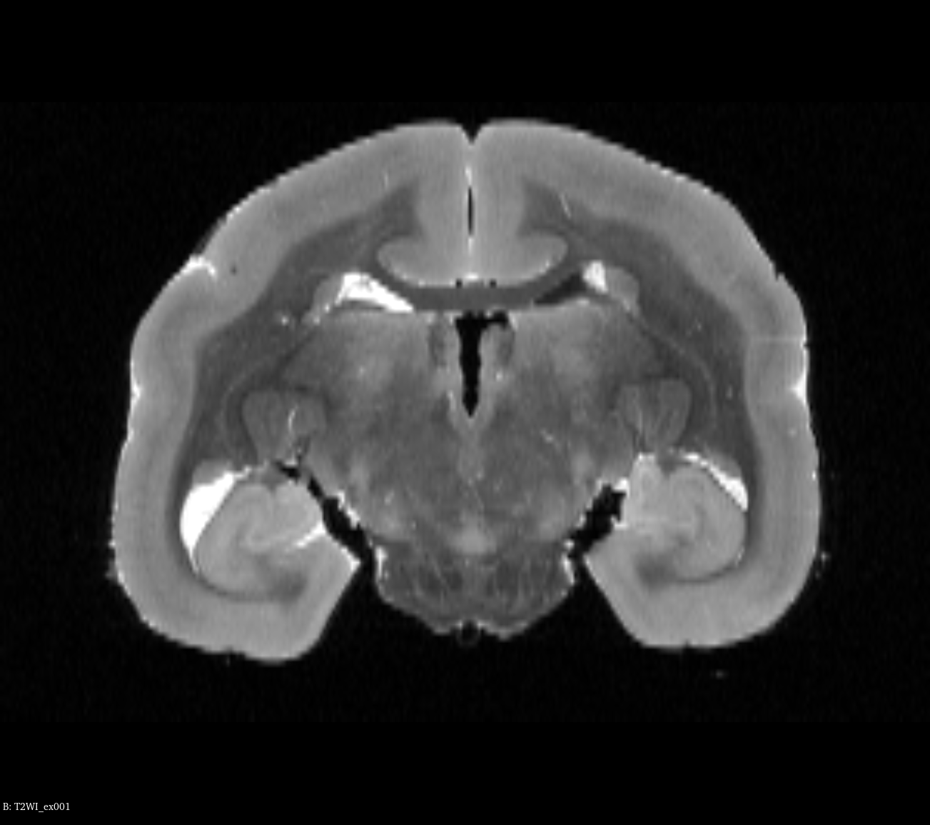 Tutorial: How to Make a Symmetric Brain - Brain/MINDS
