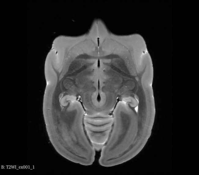 Tutorial: How to Make a Symmetric Brain - Brain/MINDS