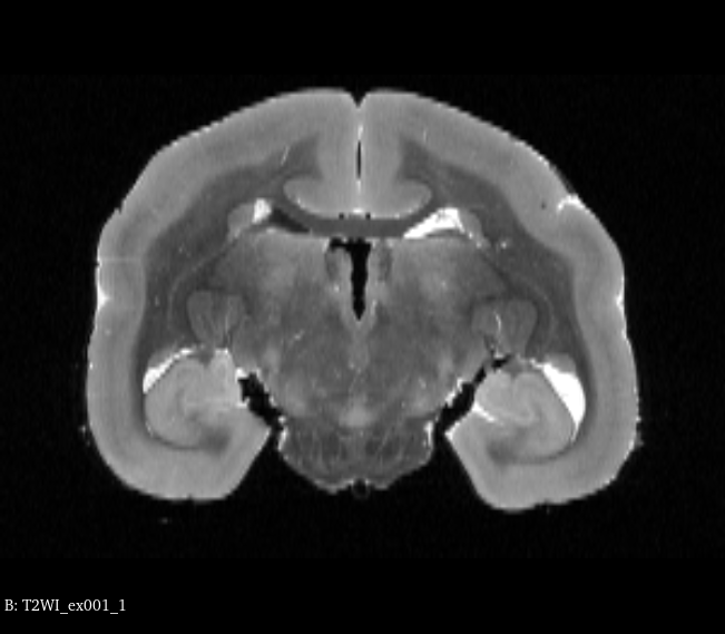 Tutorial: How to Make a Symmetric Brain - Brain/MINDS